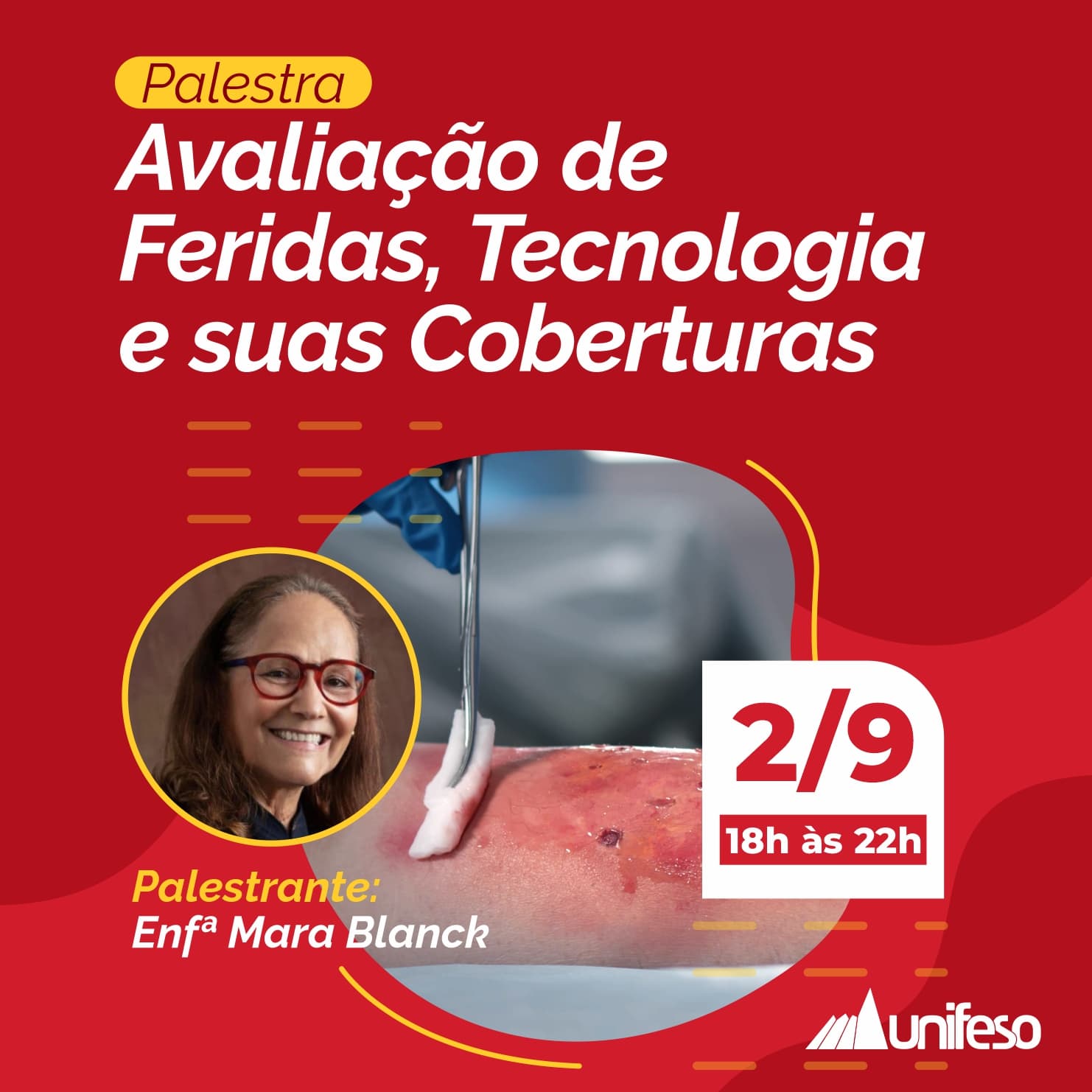Avaliação de Feridas, Tecnologia e suas Coberturas - Unifeso